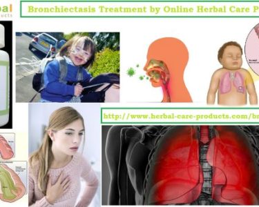 9 Natural Treatment for Bronchiectasis - Herbal Care Products - Blog