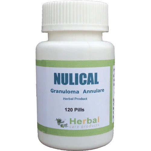 How Can I Stop Granuloma Annulare from Spreading? - Herbal Care ...