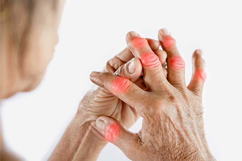 Arthritis Sufferers Swear by These 7 Supplements—Find Out Why - Herbal ...